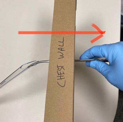 Short 🧵on the 'pointy' part of a chest tube and what happens when we ...