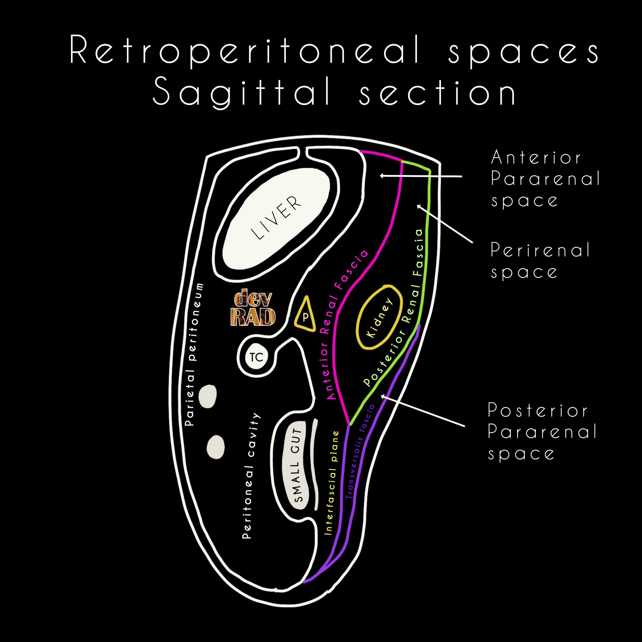 Transversalis Fascia Kidney