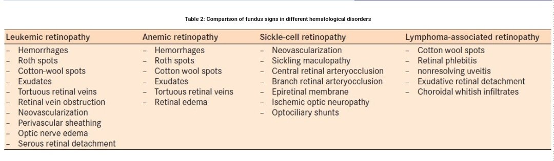 Roth Spots Endocarditis