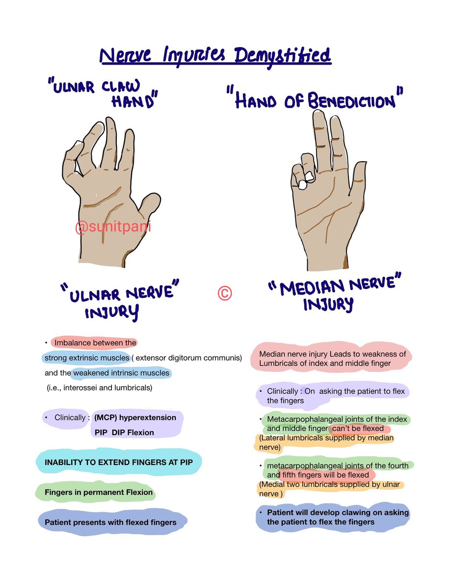 Hand Of Benediction Vs Ulnar Claw