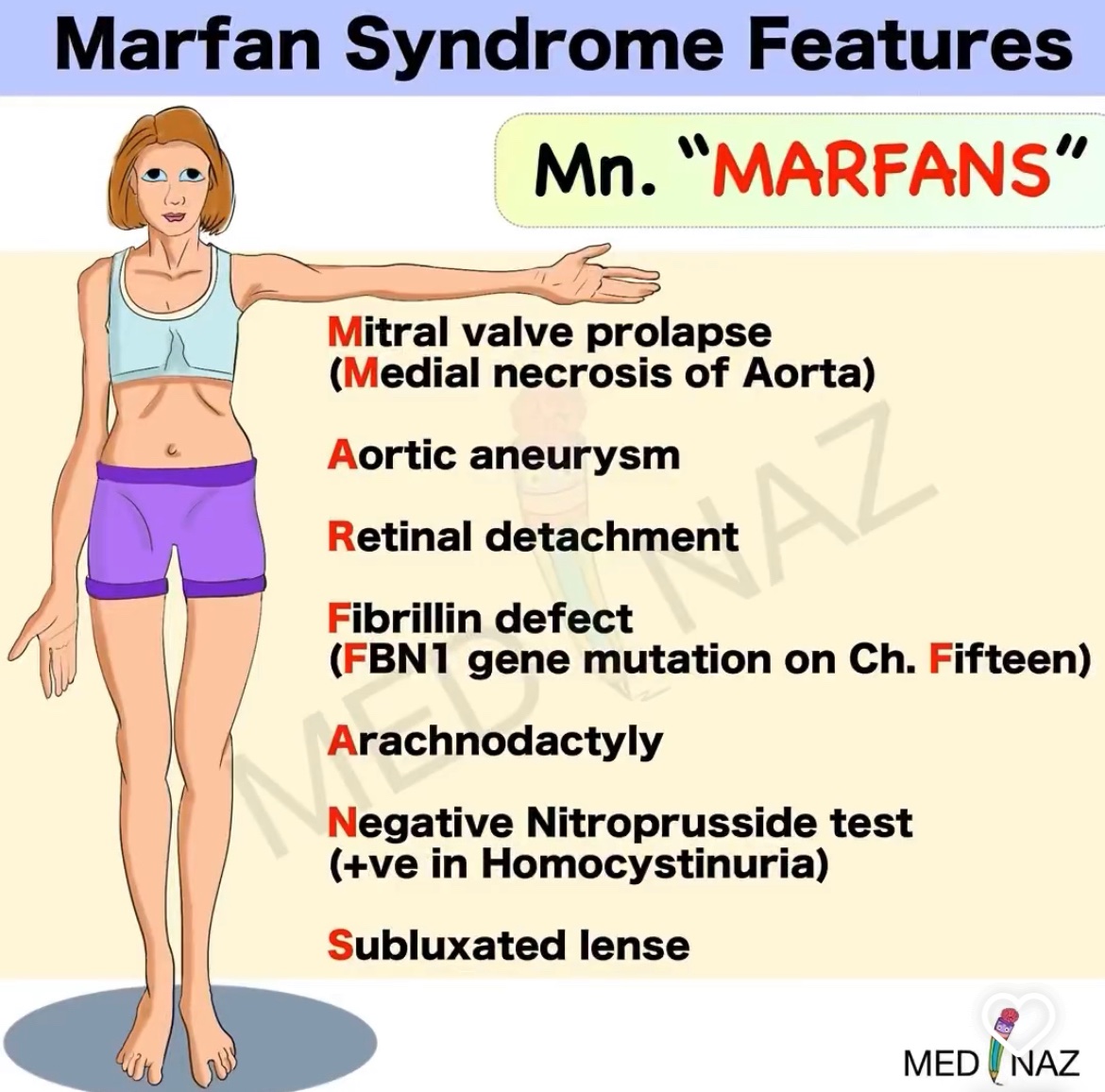 Arachnodactyly Marfan