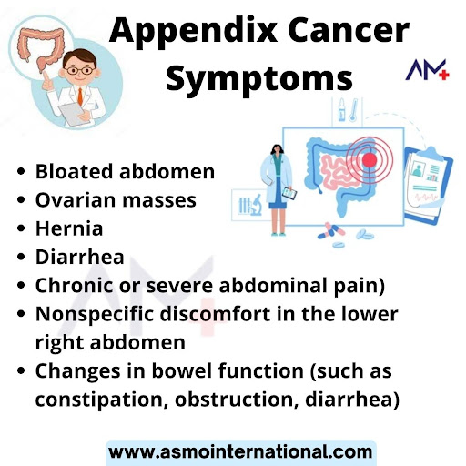 Appendix Cancer Symptoms