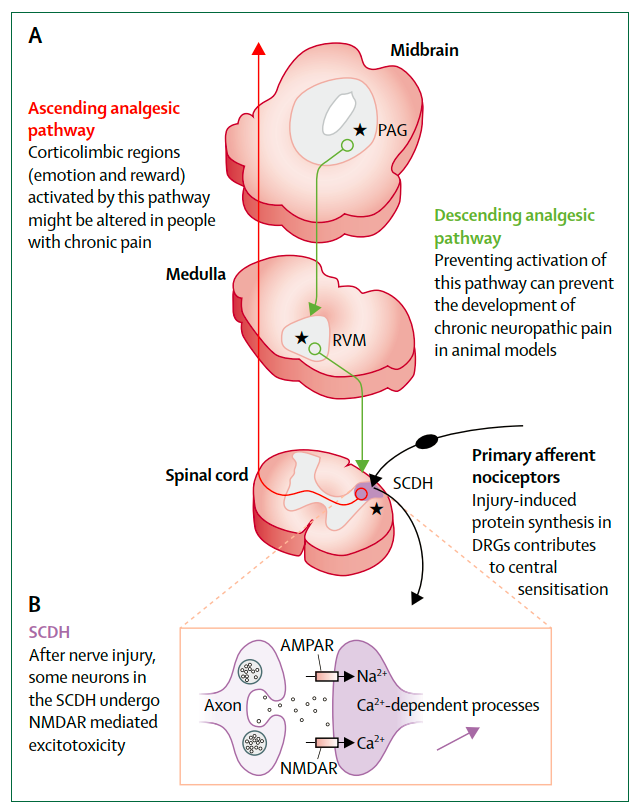 Physio Meets Science on Twitter: "Neural pathways for nociception https://t.co/0oPOq4TnX0 https ...