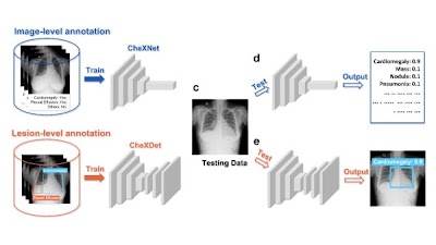 Radiology: Artificial Intelligence on Twitter: "Fine-grained chest xray annotations help # ...