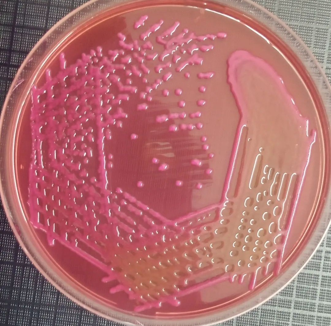 Klebsiella Pneumoniae On Macconkey Agar