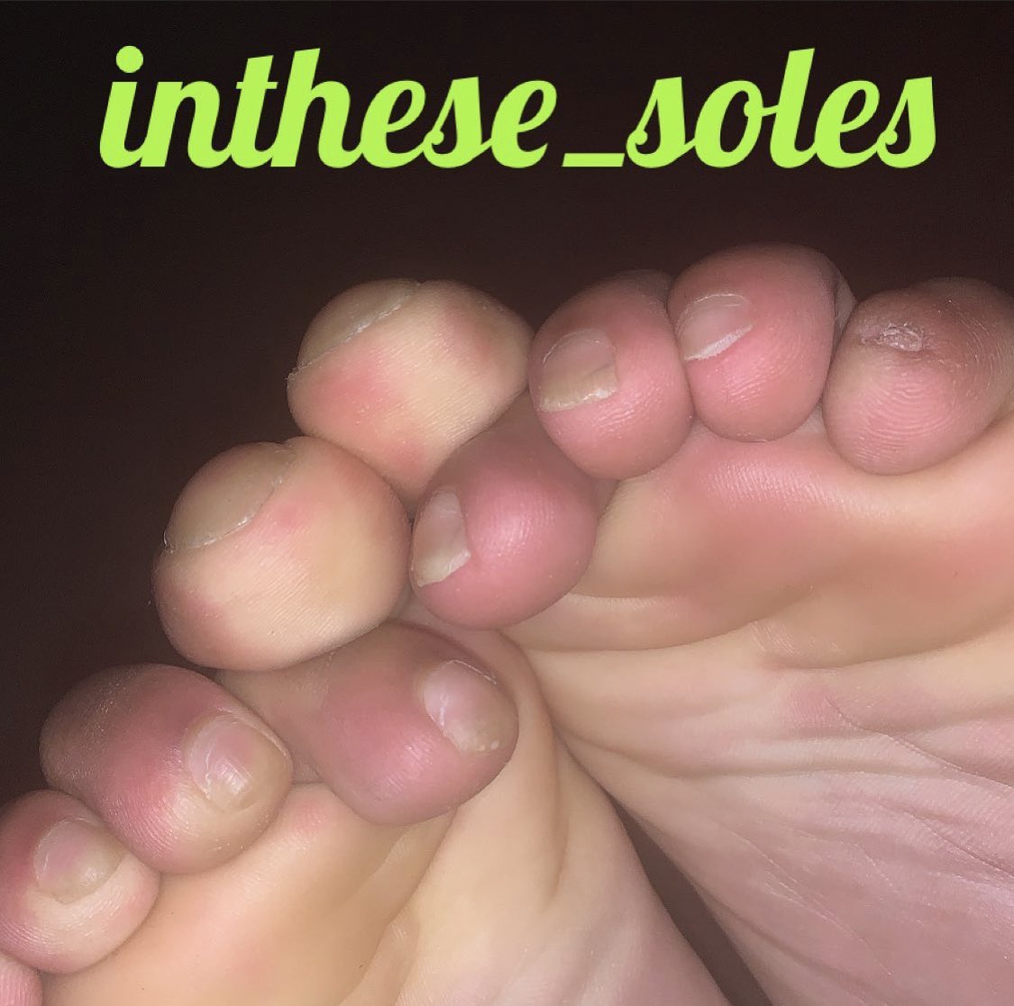 Mick On Twitter Wrinkles And Soles💦👣 Vkhjuwwuwh Twitter