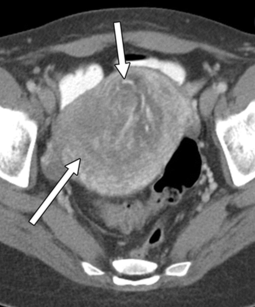 Radrounds Radiology Network Radrounds Twitter