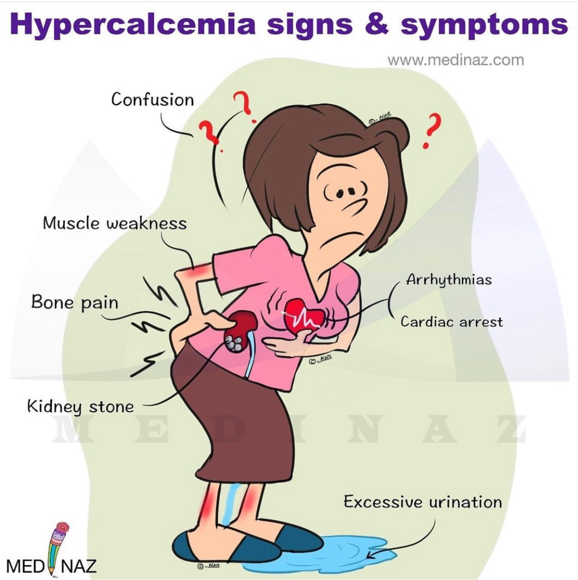 Hypercalcemia Symptoms And Signs