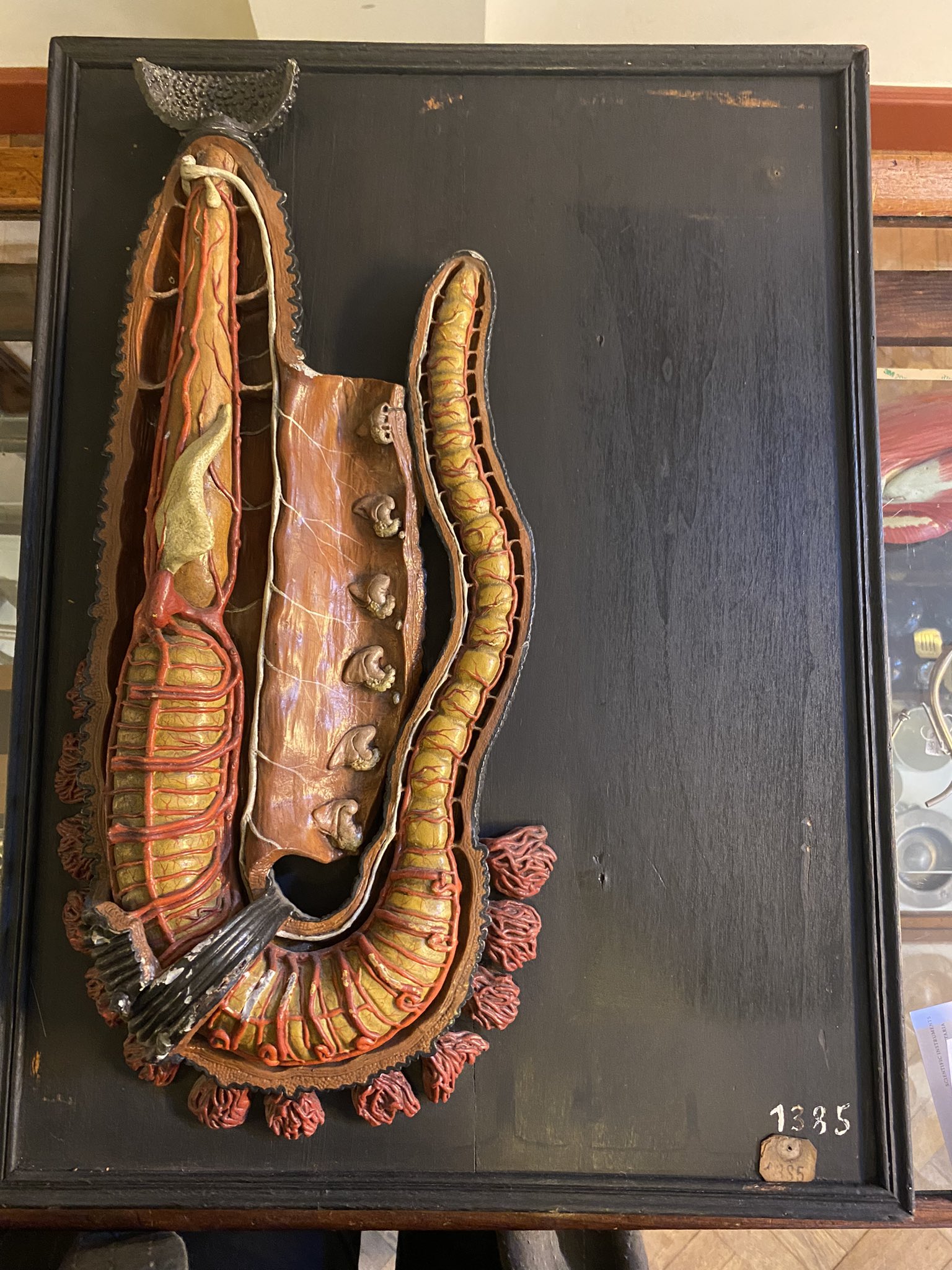 Anatomy Of Leech Full Article: Bacterial Symbioses Of The Medicinal