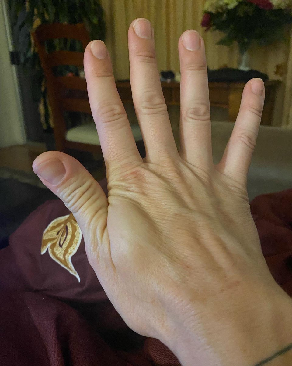 Andre Shakti On Twitter Guess Which Hand Is My Dominant Fisting Mitt