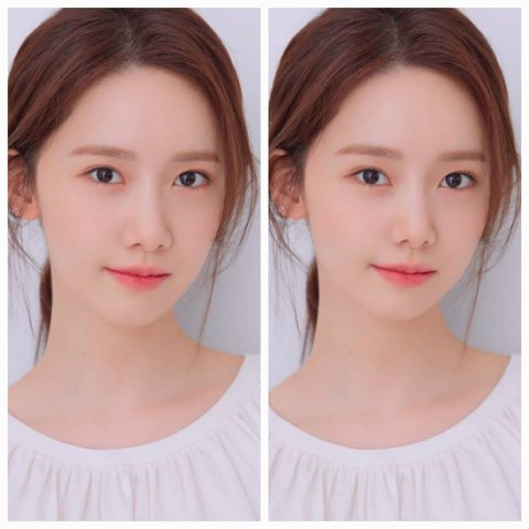 Yoona Plastic Surgery