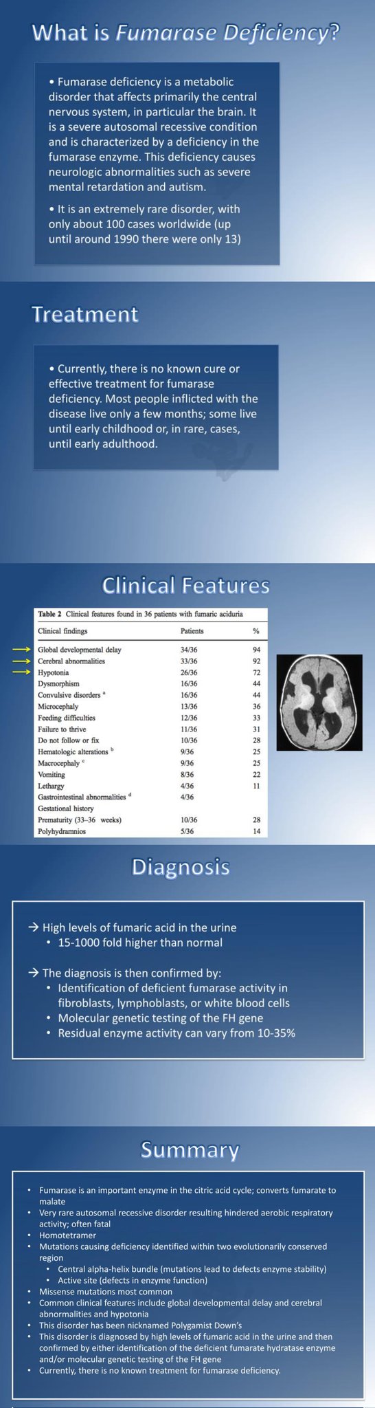 Fumarase Deficiency