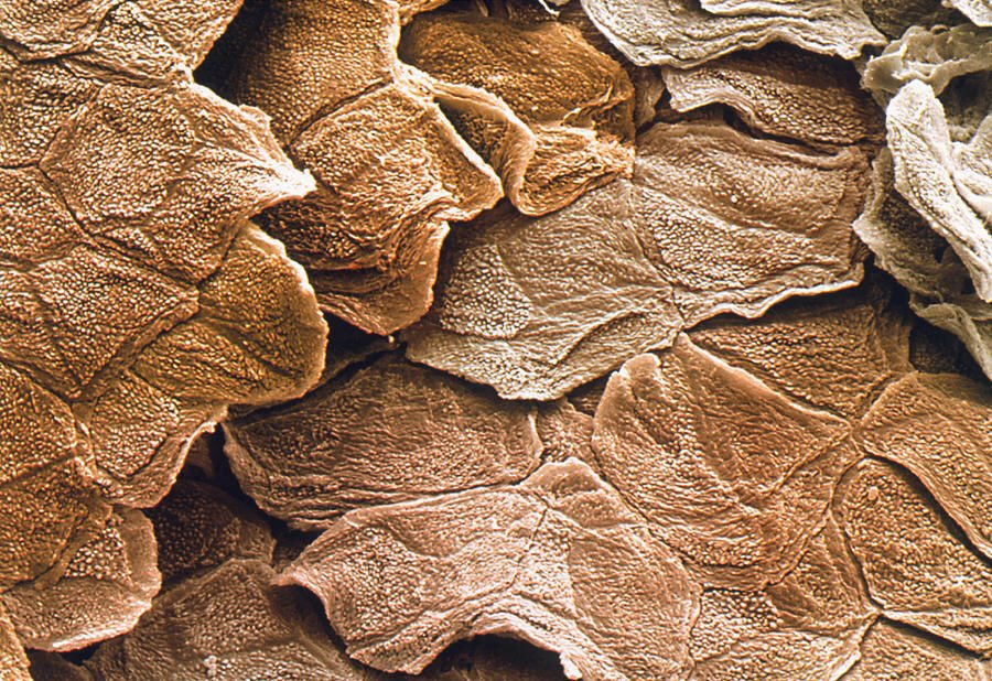 Human Epidermis Microscope