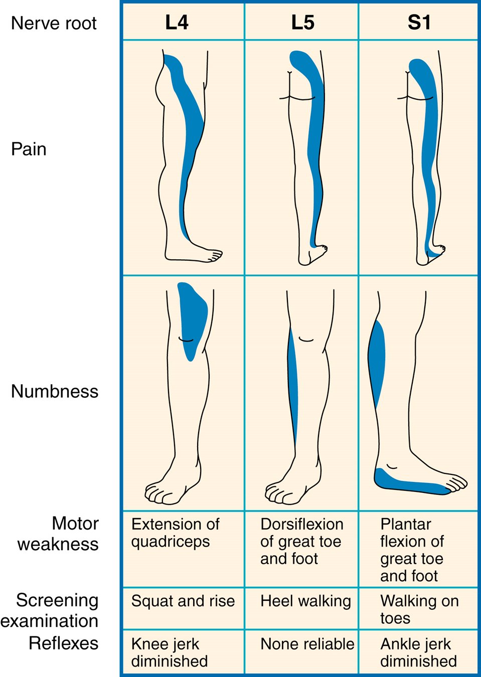 Ankle Dorsiflexion Nerve Root