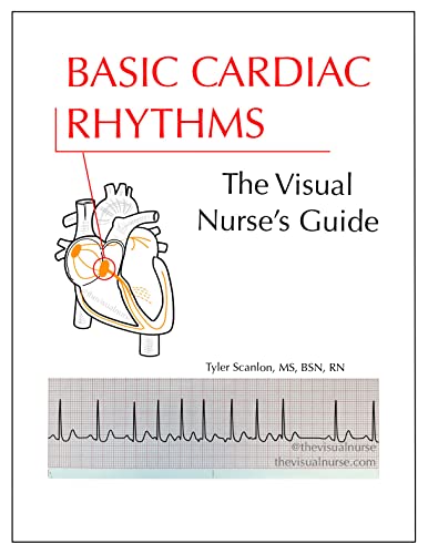 Download# Basic Cardiac Rhythms: The Visual Nurse's Guide (The Visual Nurse's Basic ECG Series ...