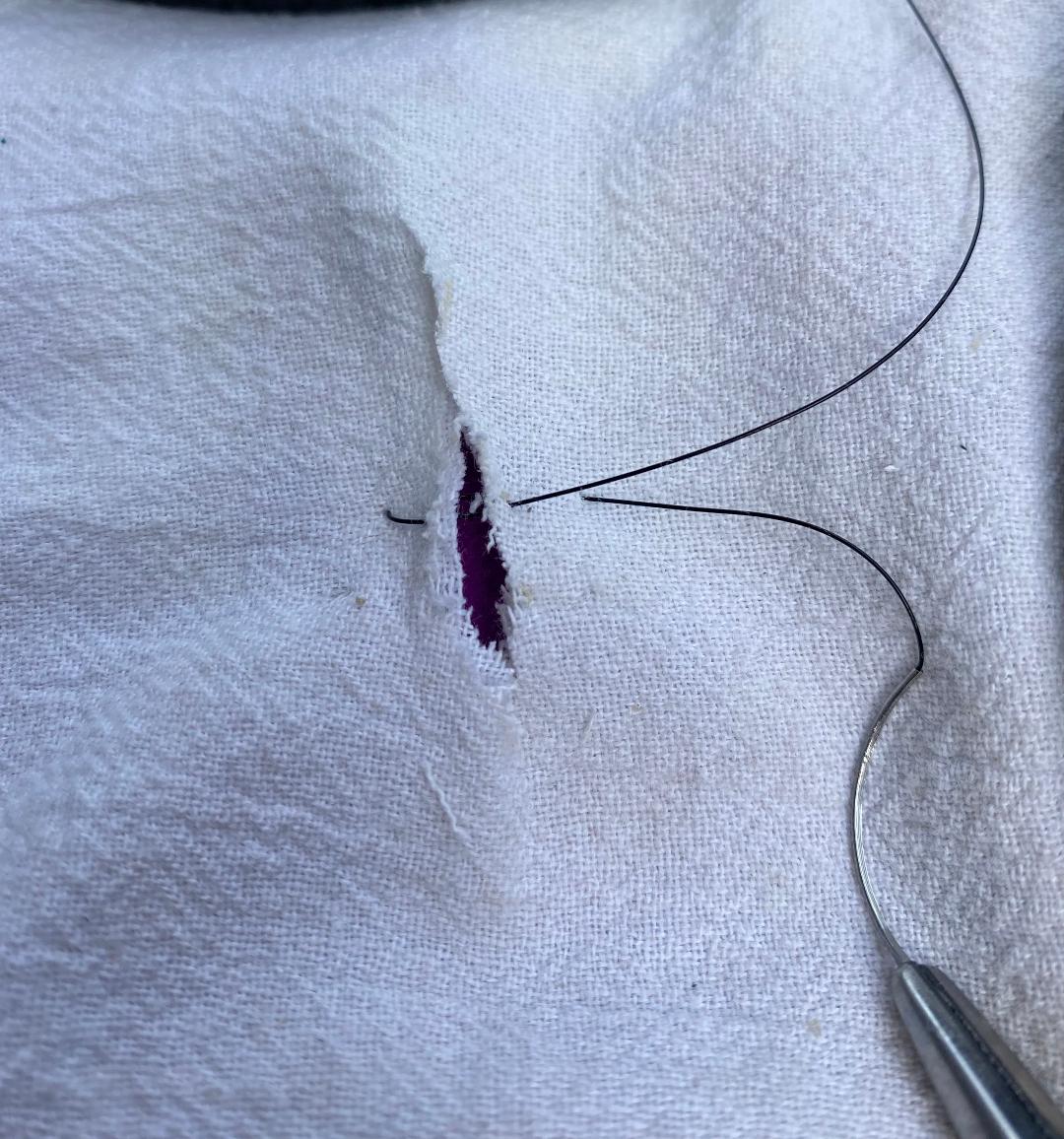 Short 🧵on a few technical points of vertical mattress sutures. I won't ...