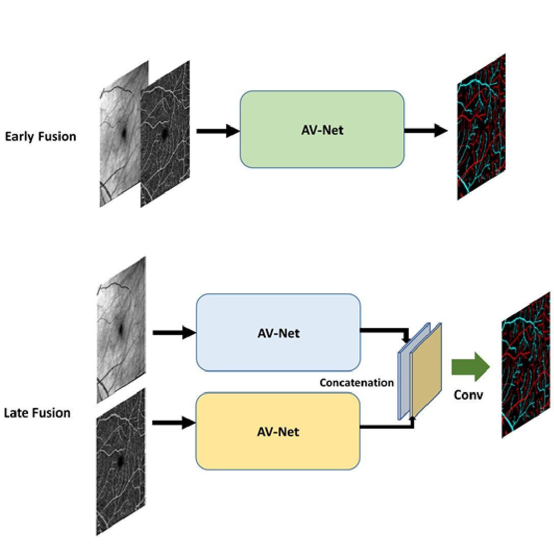 Optica Publishing Group on Twitter: "An Editors' Pick via #OPG_BOEx: MF ...