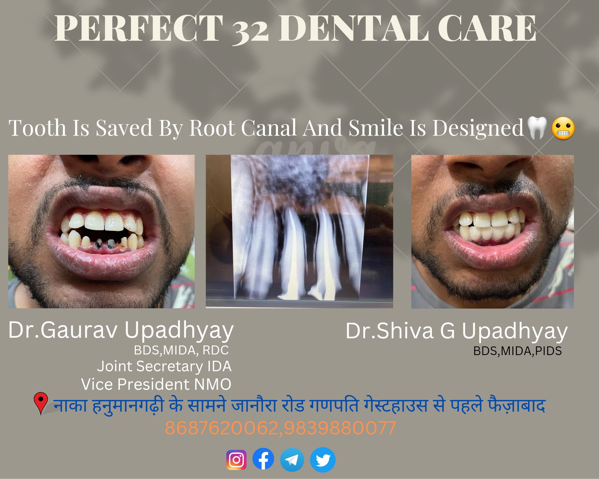 perfect 32 dental care ayodhya faizabad (@perfect32fzd) / Twitter