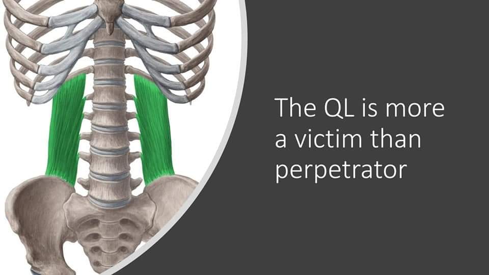 Lateral pelvic tilt في هذا الثريد بنتكلم عن #Lateral_pelvic_tilt # ...