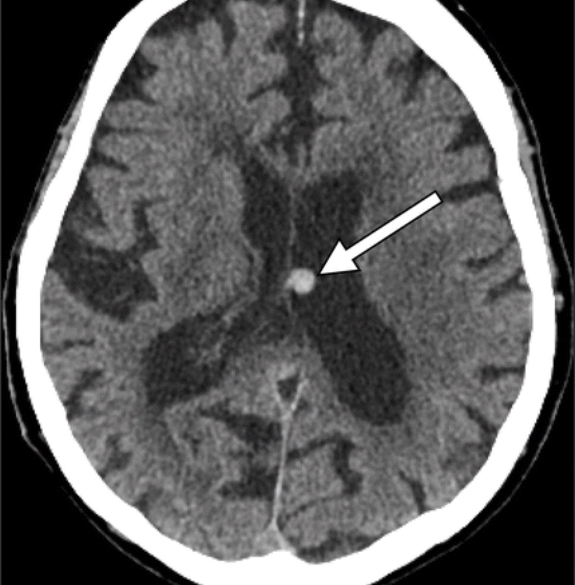 Radrounds Radiology Network Radrounds Twitter