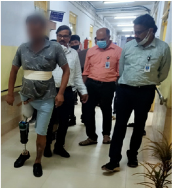 ISRO on Twitter: "ISRO develops a spin-off intelligent artificial limb for above-knee amputees ...