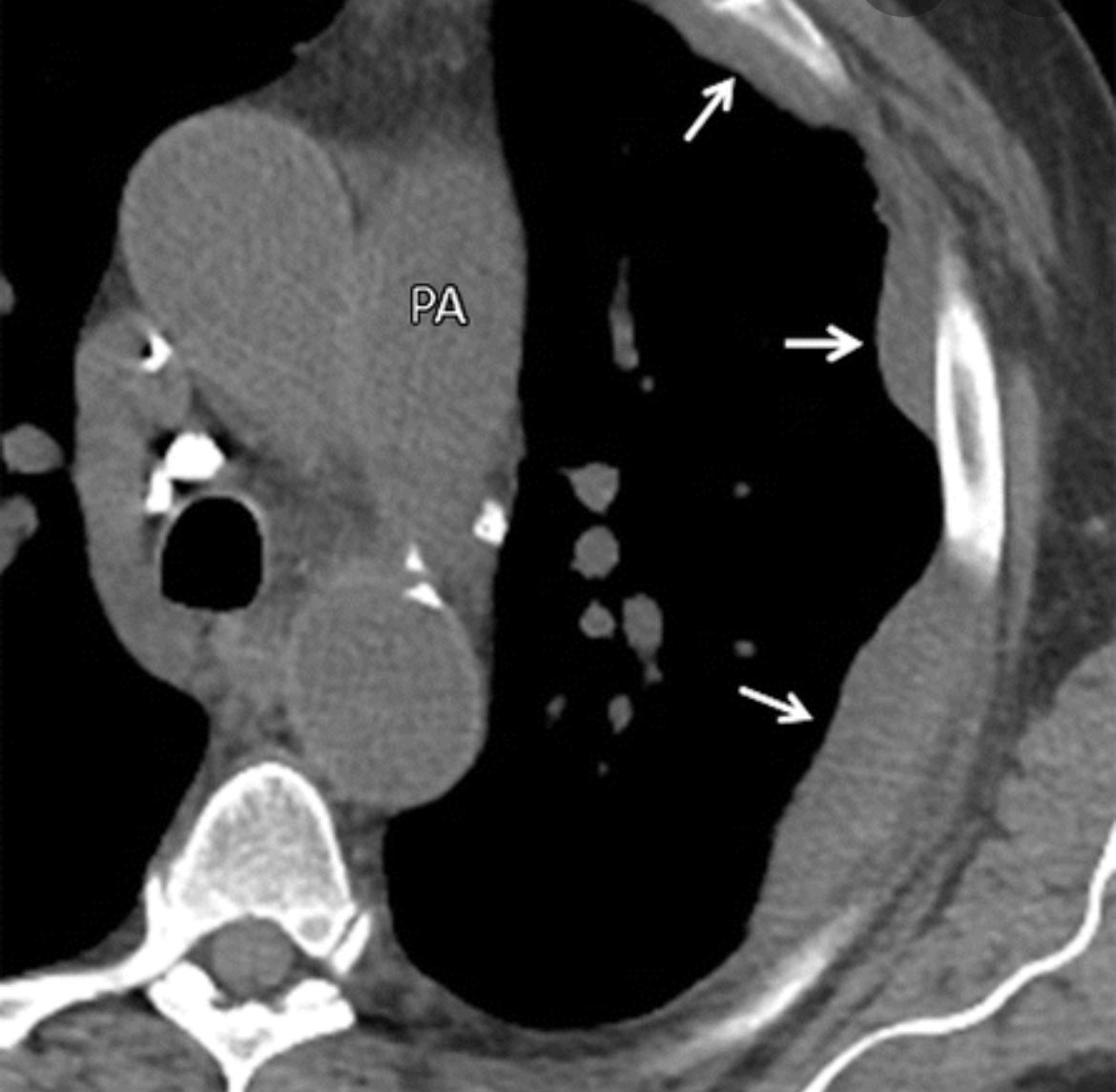 Radrounds Radiology Network Radrounds Twitter