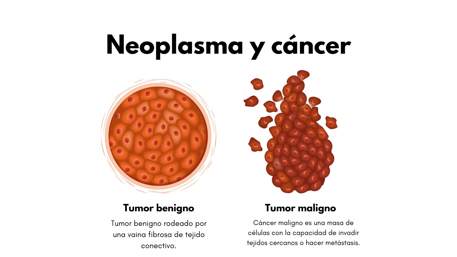 Tumor Benigno Vs Maligno