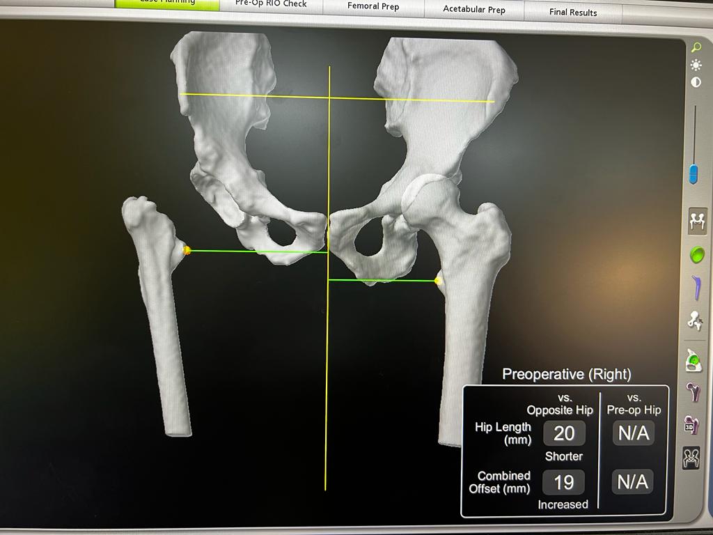48 year old Mr N came to us with a unique problem. His right leg was ...