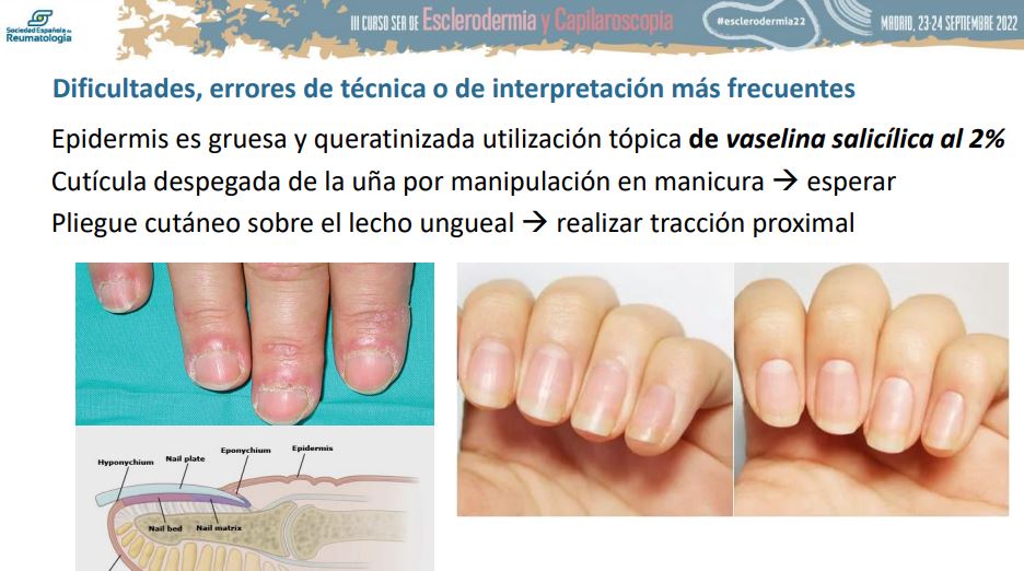 Soc.Esp.Reumatología on Twitter: Soc.Esp.Reumatología on Twitter:
