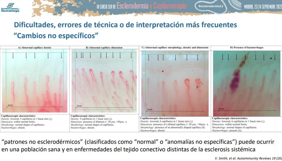 Soc.Esp.Reumatología on Twitter: Soc.Esp.Reumatología on Twitter: