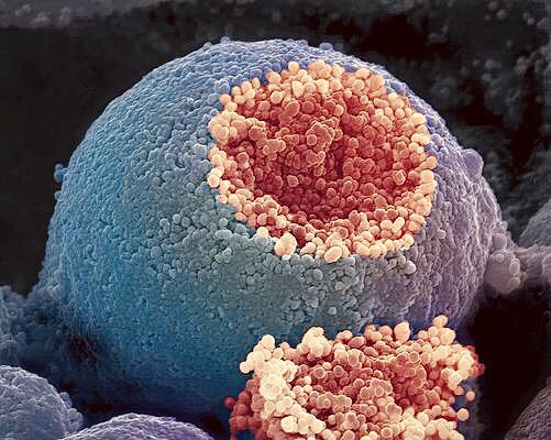 Nerve Cell Under Electron Microscope