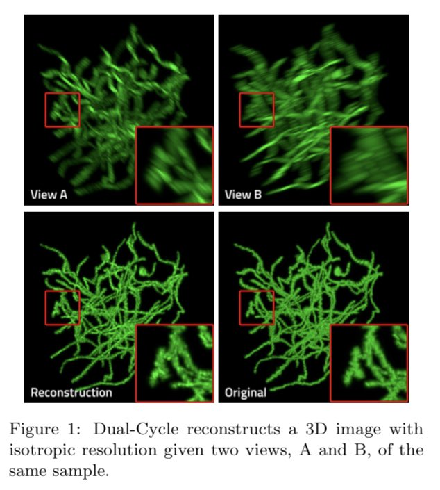 Uri Manor on Twitter: "RT @wustlcig: New paper "Dual-Cycle: Self-Supervised Dual-View ...