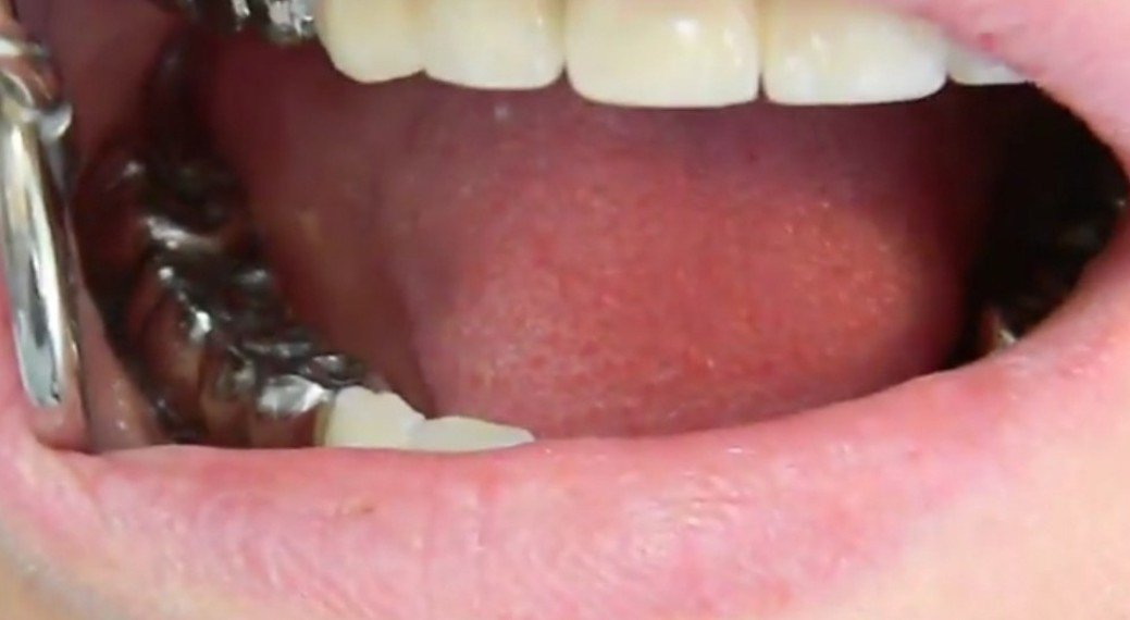 Gold and Silver Teeth Lover on Twitter: "https://t.co/qLwbyhijZf" / Twitter