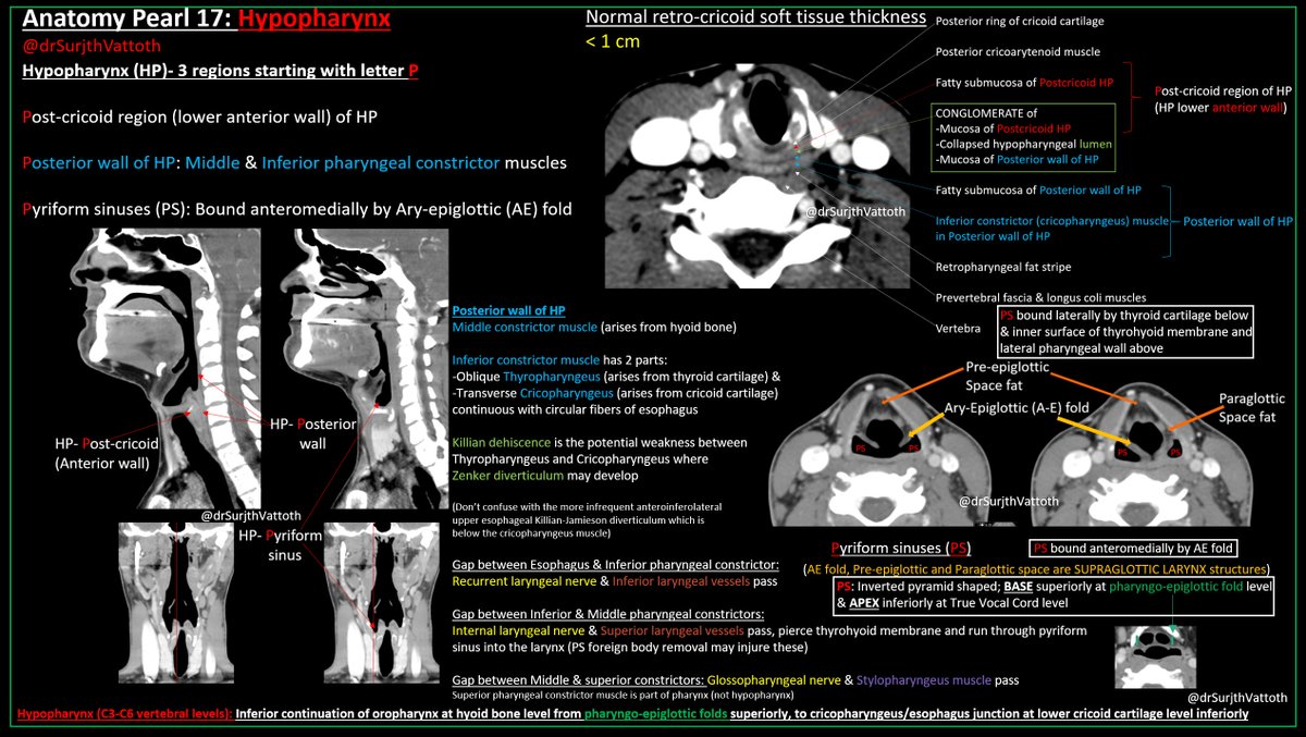 Thyropharyngeus