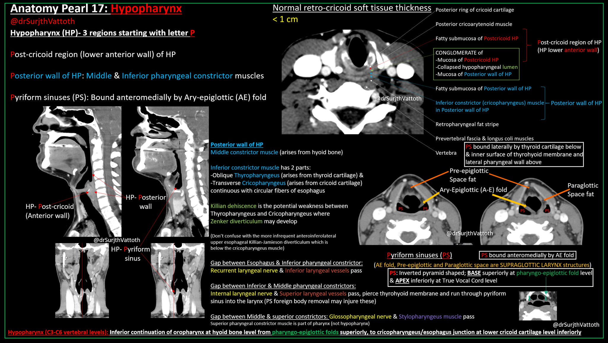 Pyriform Sinus Anatomy