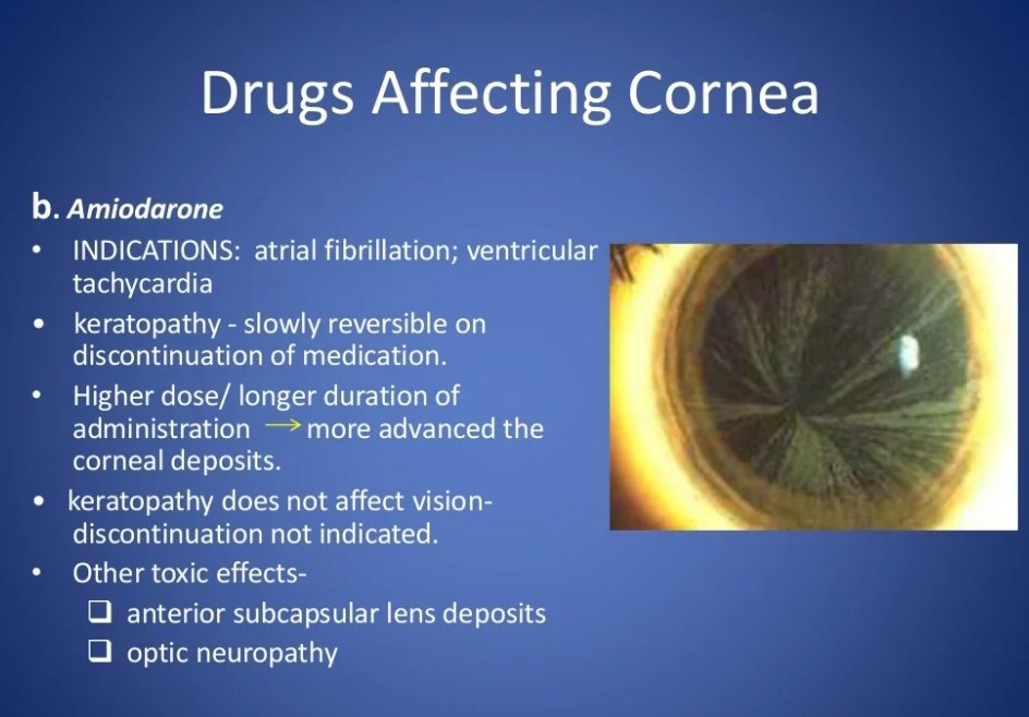 Amiodarone Side Effects