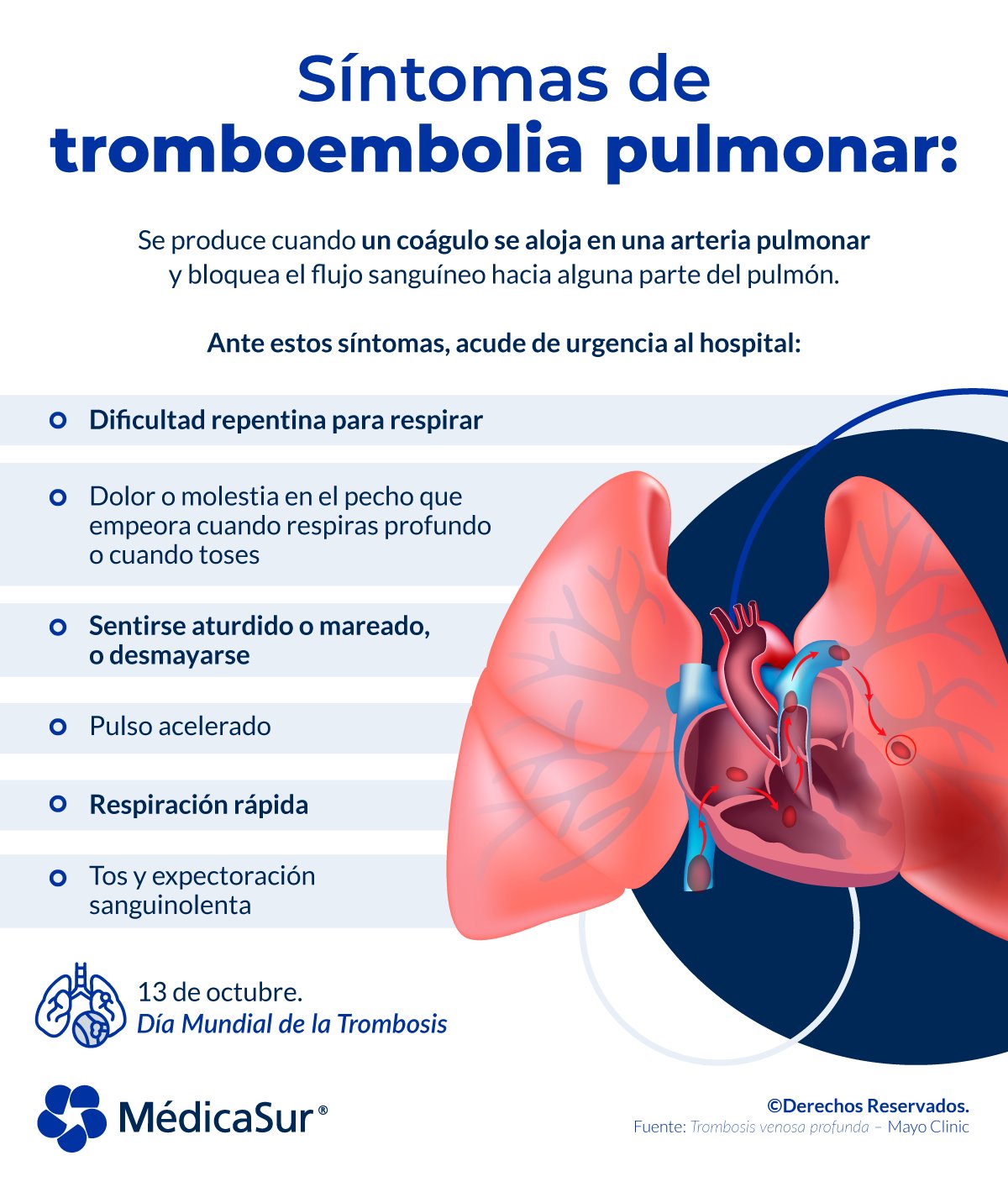Causas De Embolia Pulmonar