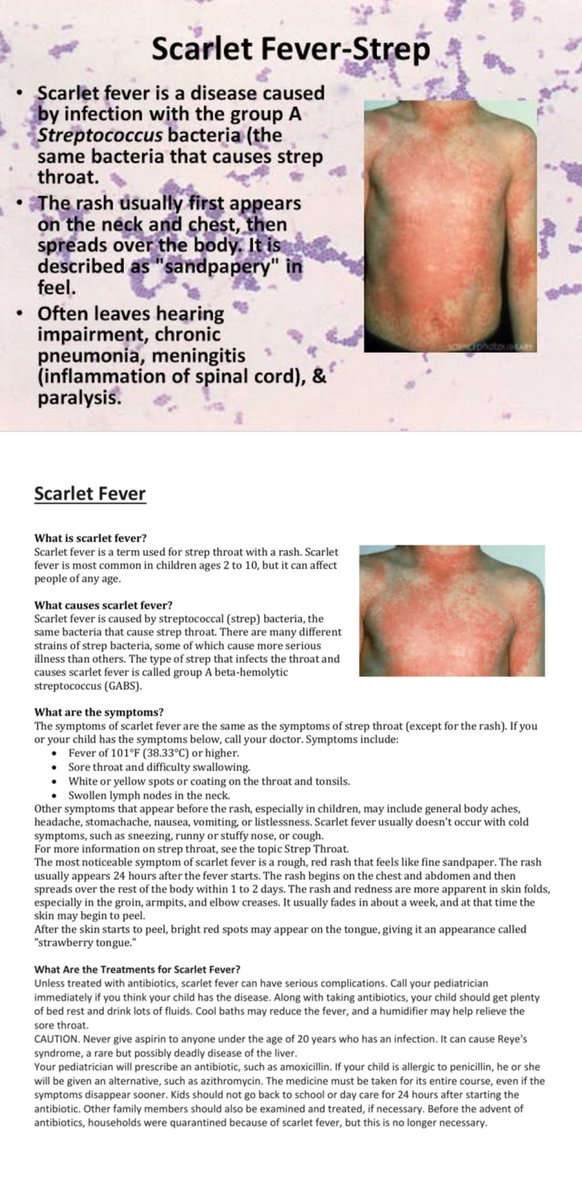 Sthanu On Twitter Scarlet Fever