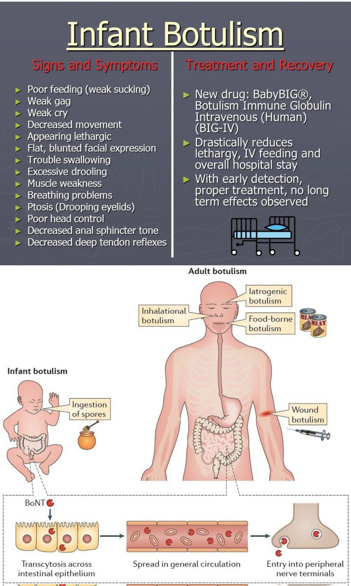 Clostridium Botulinum Symptoms