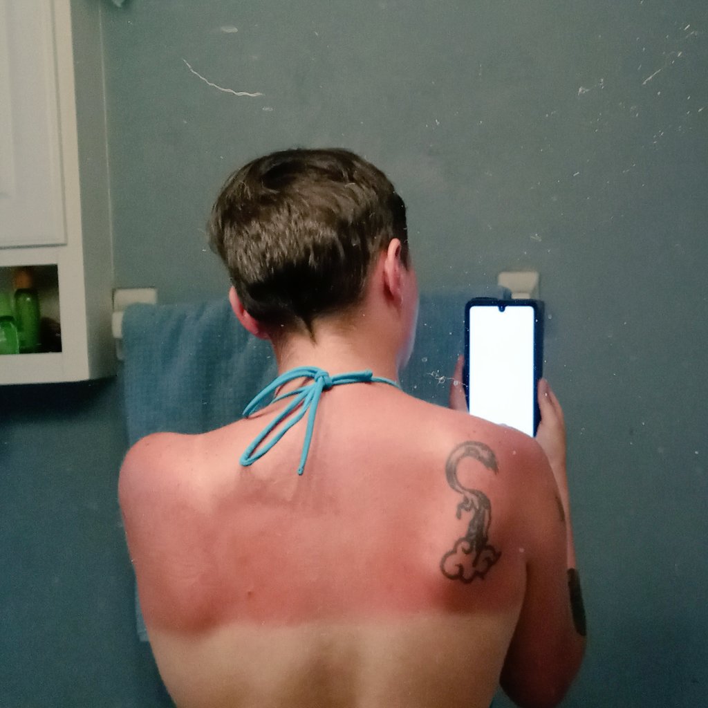 🏳️‍⚧️The Vtuber Grandpa🔞Samuel Higgins🐙 on Twitter: "Mistakes were made...i am so sunburned ...