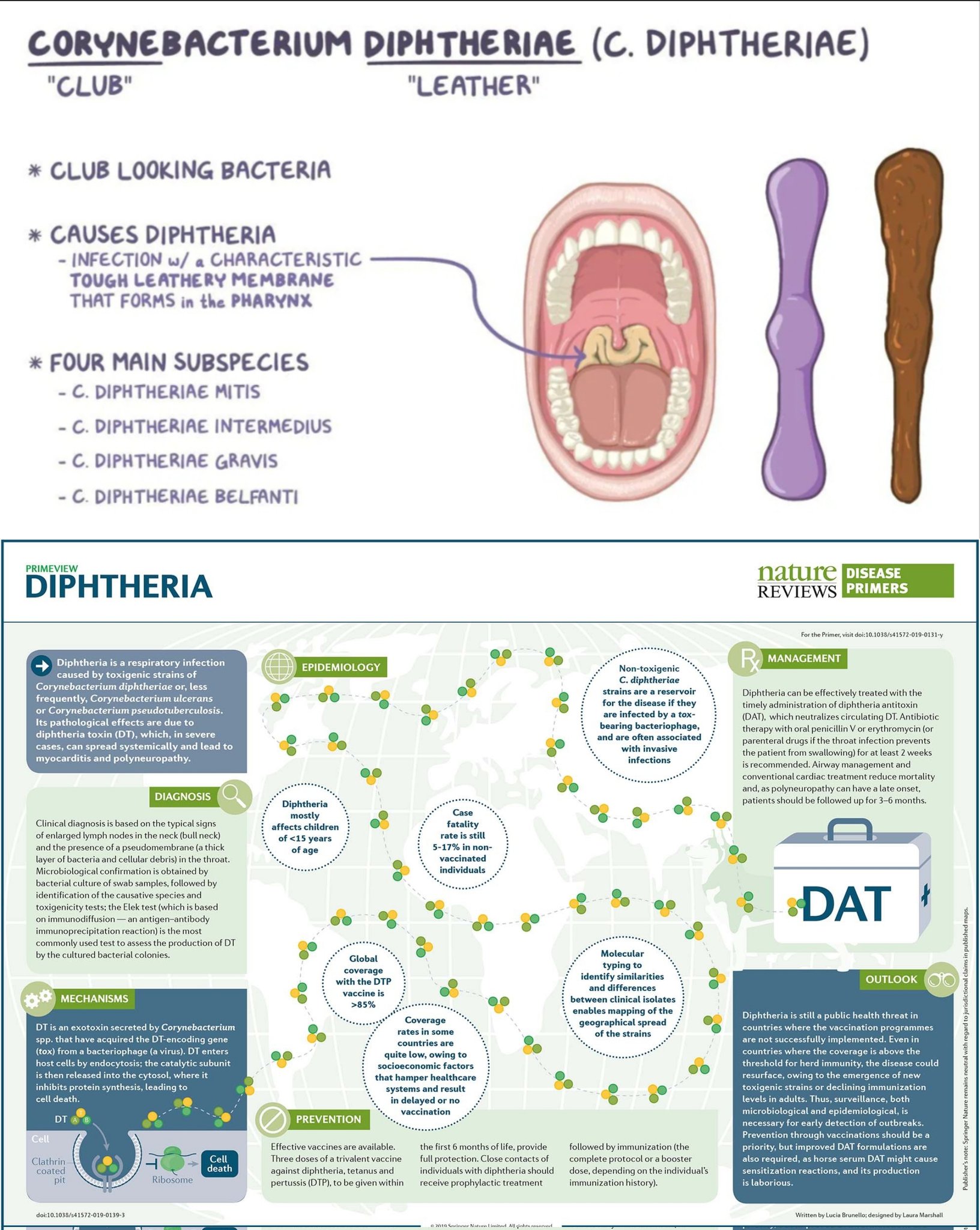 Diphtheria Pseudomembrane