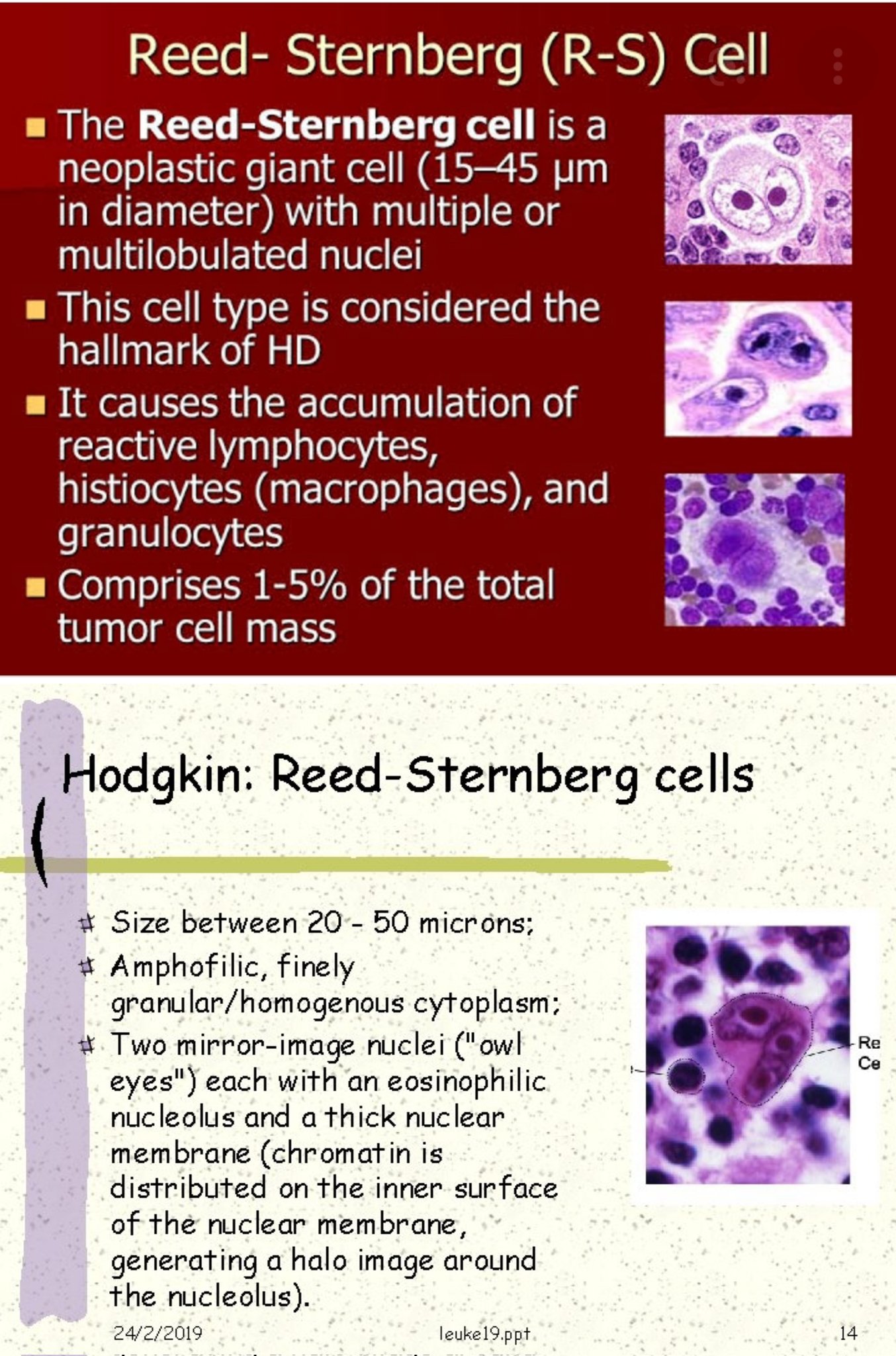 Reed Sternberg Cells
