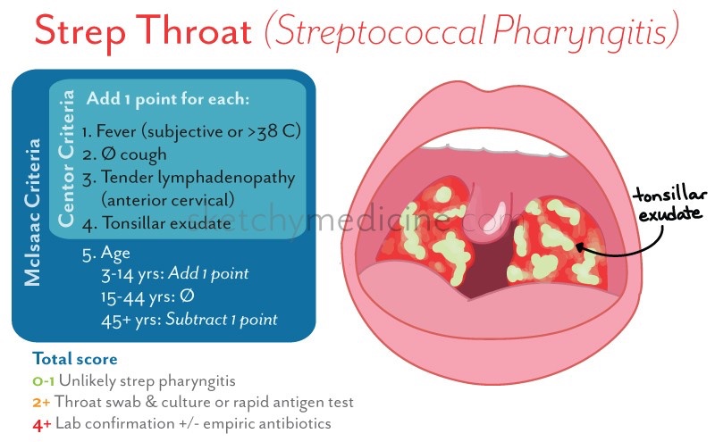 Brown Hospital Medicine On Twitter Streptococcal Pharyngitis Strep Throat Sketchy Medicine