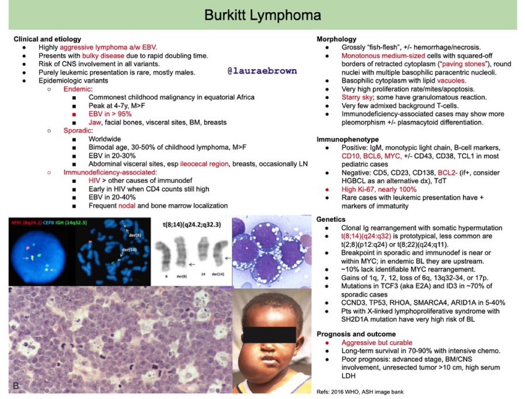 Brown Hospital Medicine on Twitter: "Burkitt Lymphoma (Image also from M.A Ansary Science ...
