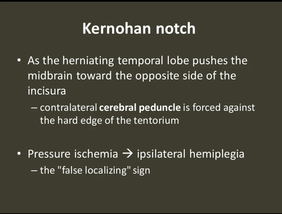 Thread by @OGdukeneurosurg on Thread Reader App – Thread Reader App