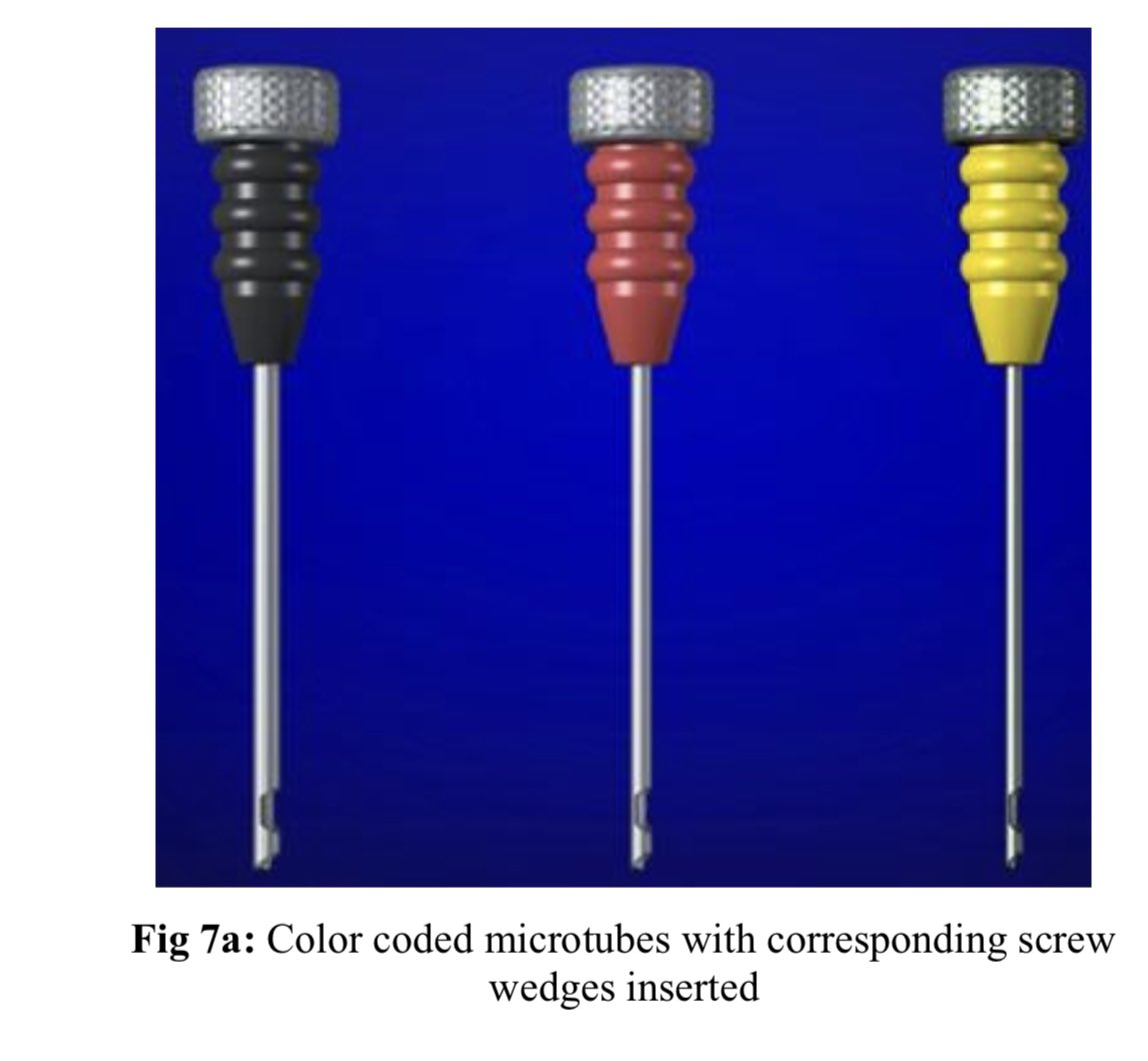 قبل ما تقرر تعمل منجمنت لفايل مكسور ، في اشياء لازم تعرفها وتقيمها كويس ...