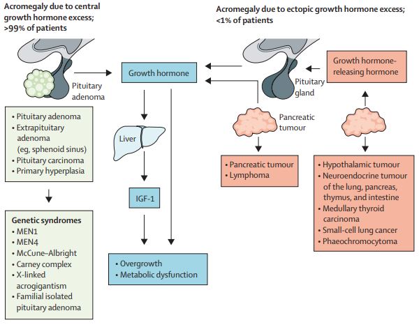 The Lancet Diabetes And Endocrinology On Twitter New—acromegaly