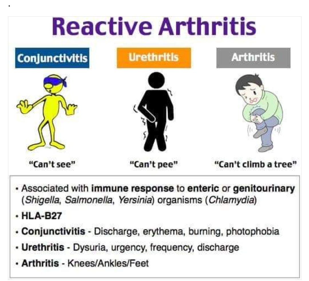 Reactive Arthritis Conjunctivitis