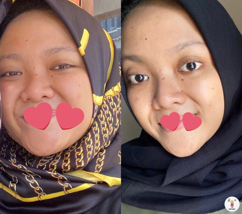 DIETHINGY on Twitter: "Diet! Losing weight from your face is biggest ...