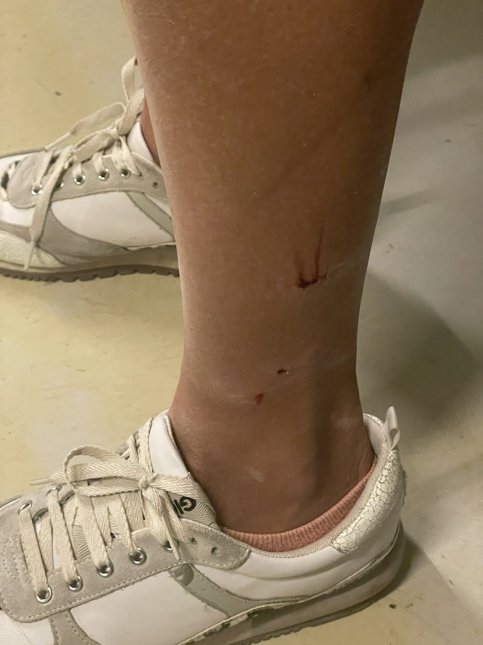 The Templar On Twitter Вечерва жена ми ја нападнало улично куче кај град скопје во парк